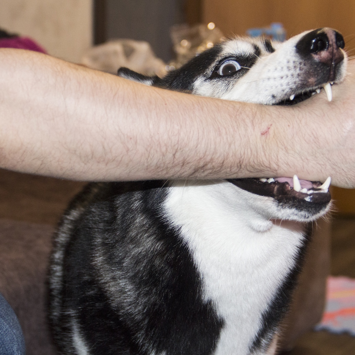 Filing a Claim After a Dog Bite Injury - Craft Play Learn